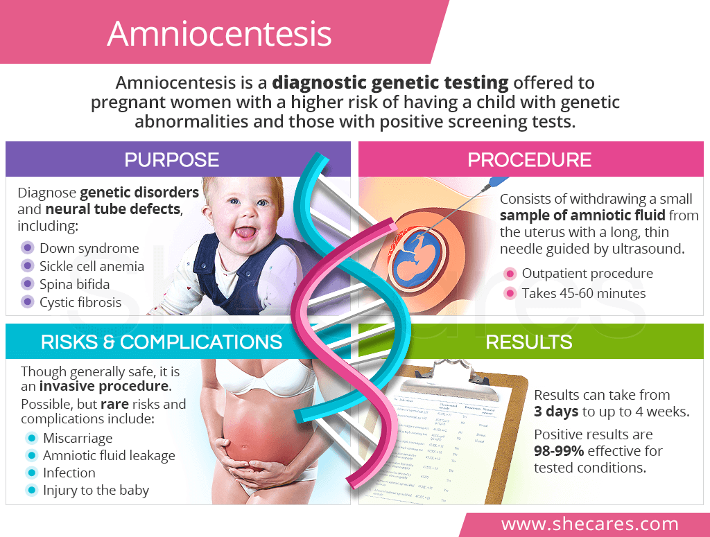 Prenatal Test – Amniocentesis – The risks